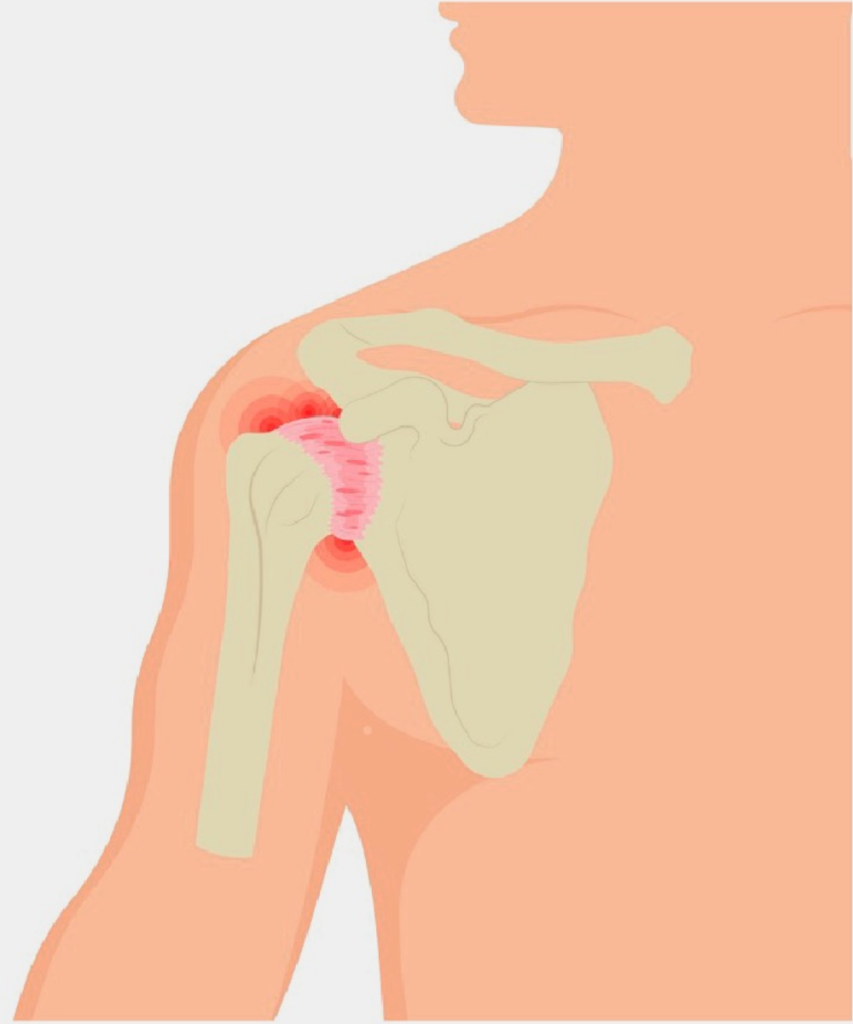 Take 60 Minutes To Try This Amazing Shoulder Workout At Home