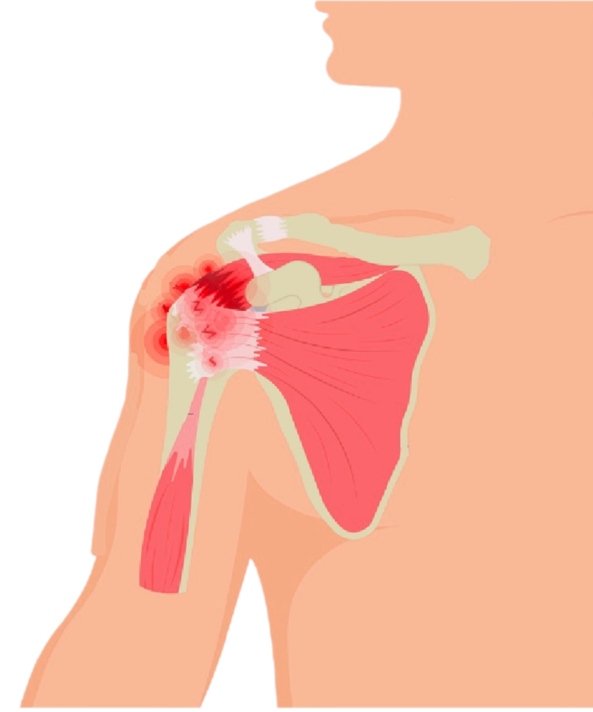 Take 60 Minutes To Try This Amazing Shoulder Workout At Home